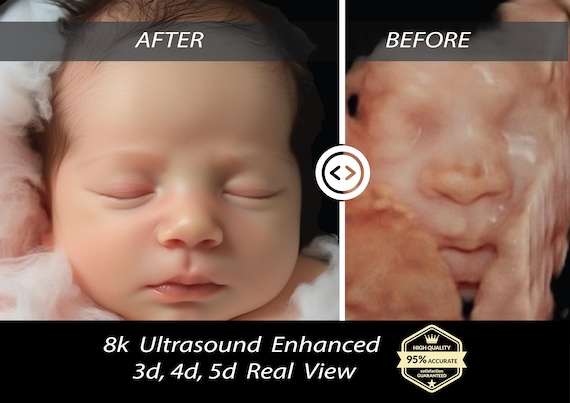 Ultrasound Baby 3D / 4D / HD Live Ultrasound Sessions At Bella
