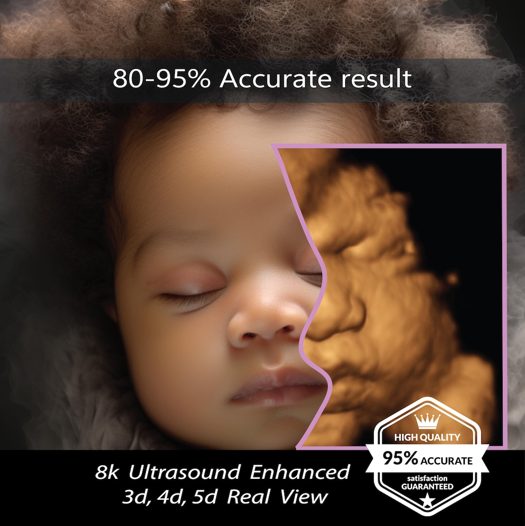 8K Enhanced Ultrasound Baby Scan: Custom 3D/4D/5D Real View - Etsy