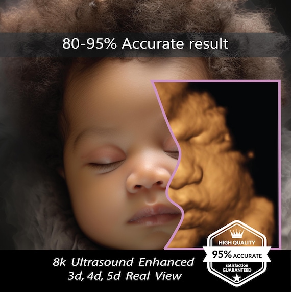Ultrasound Baby 3D / 4D / HD Live Ultrasound Sessions At Bella