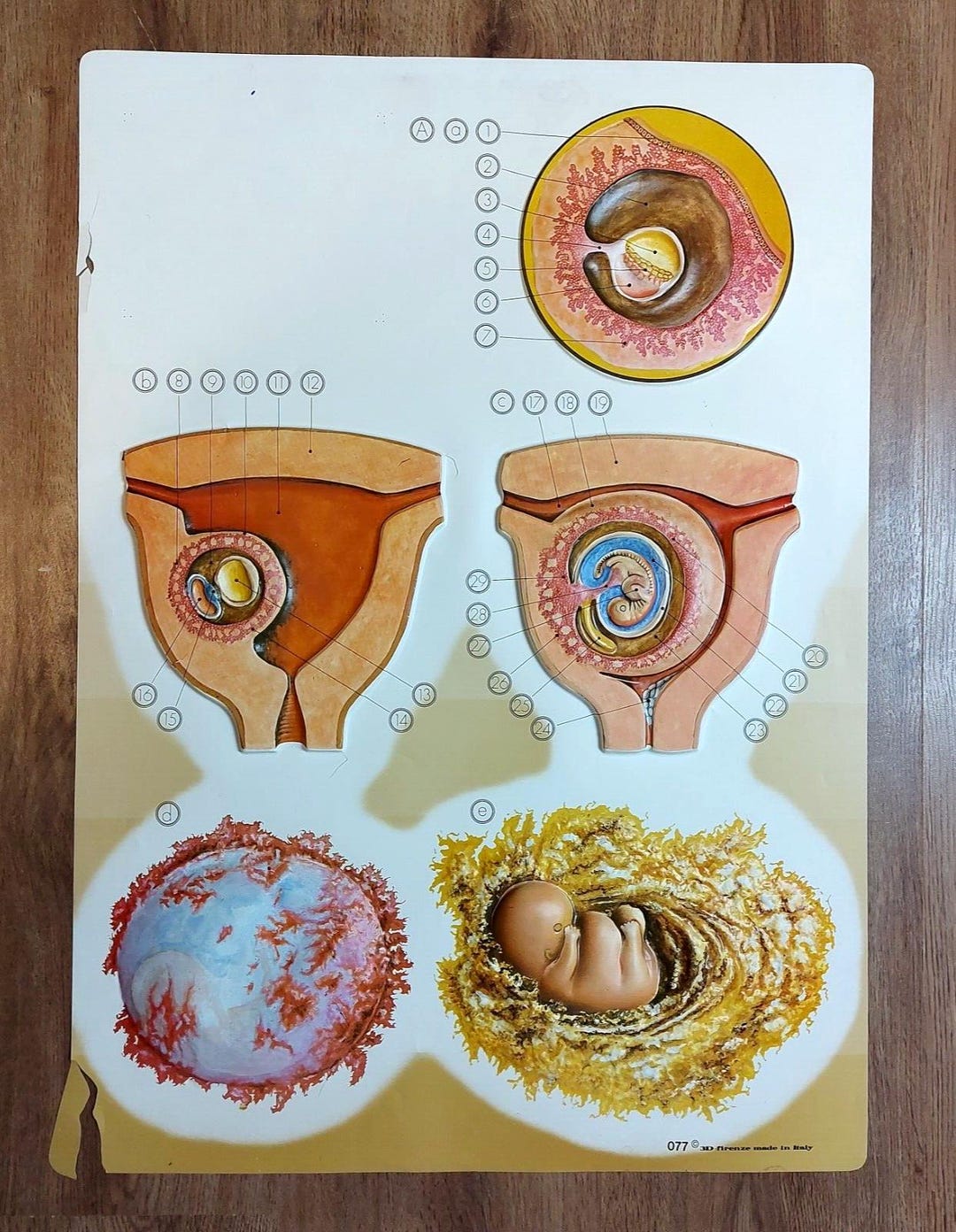 Vintage Anatomy Illustration of Embryo Embossed Plastic Poster Medical ...