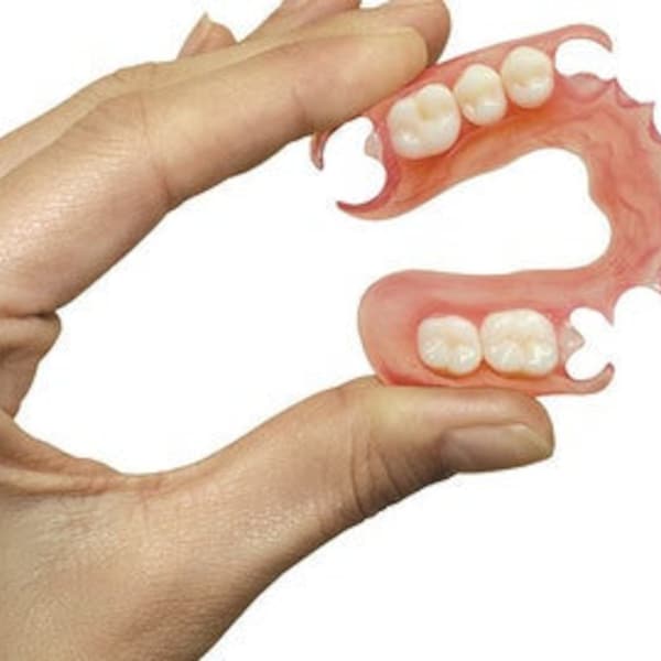 Snap on Veneer Home Kit - Etsy