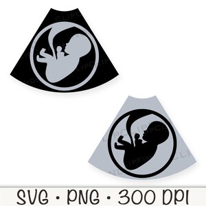 Baby Sonogram, Embryo, Fetus, SVG, PNG, Instant Digital Download - Etsy