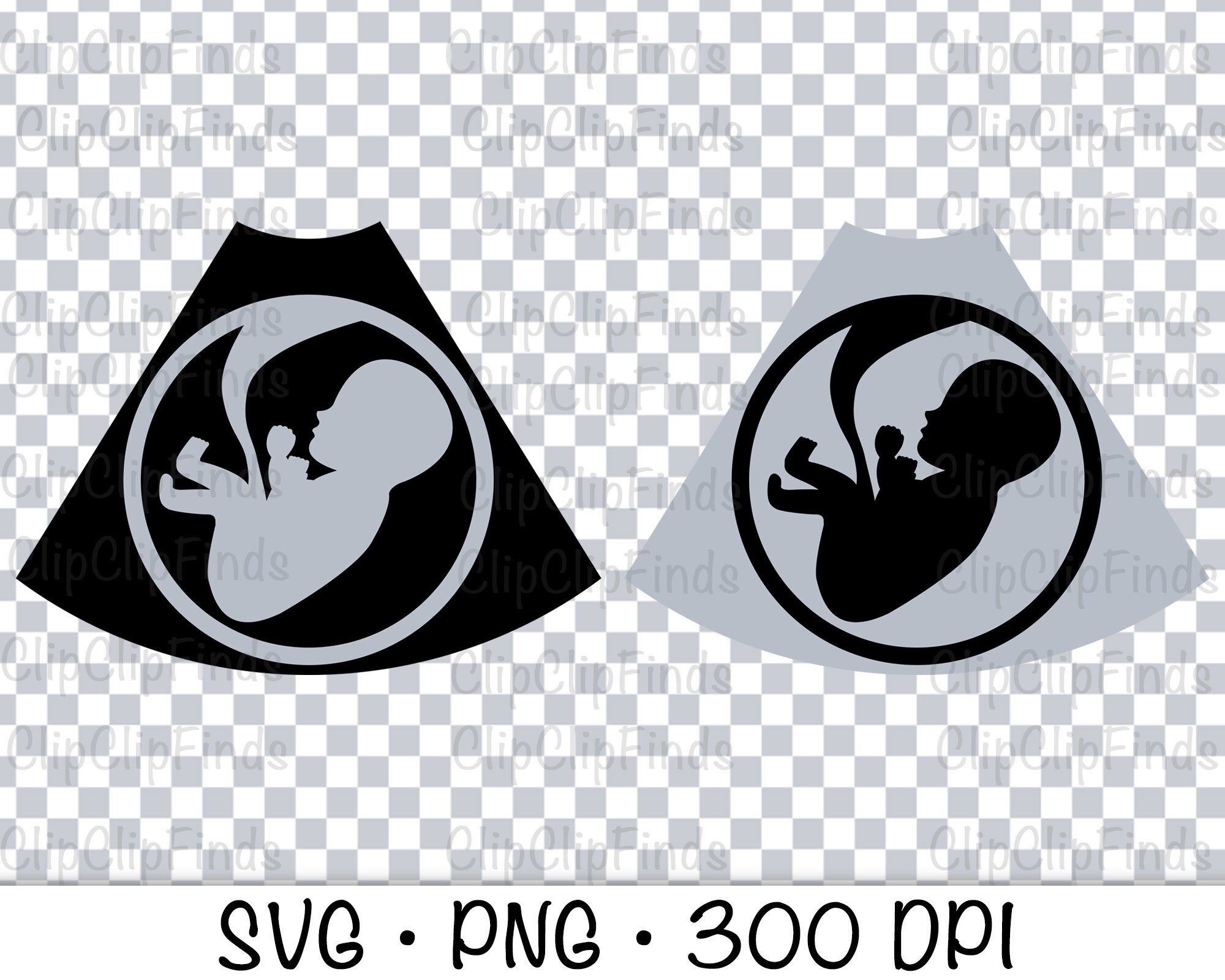 Baby Sonogram Embryo Fetus SVG PNG Instant Digital - Etsy