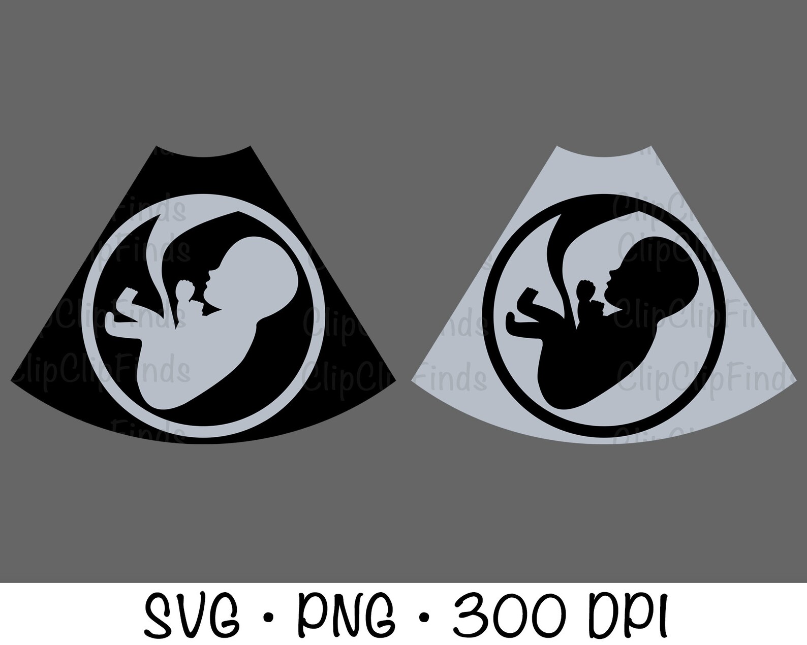Baby Sonogram Embryo Fetus SVG PNG Instant Digital | Etsy