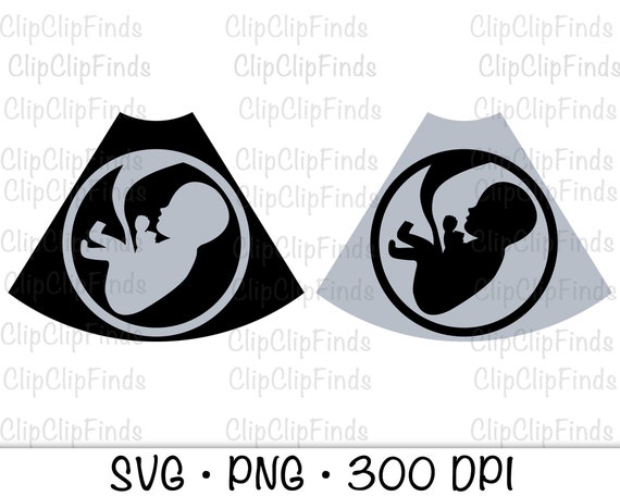 Baby Sonogram Embryo Fetus SVG PNG Instant Digital | Etsy