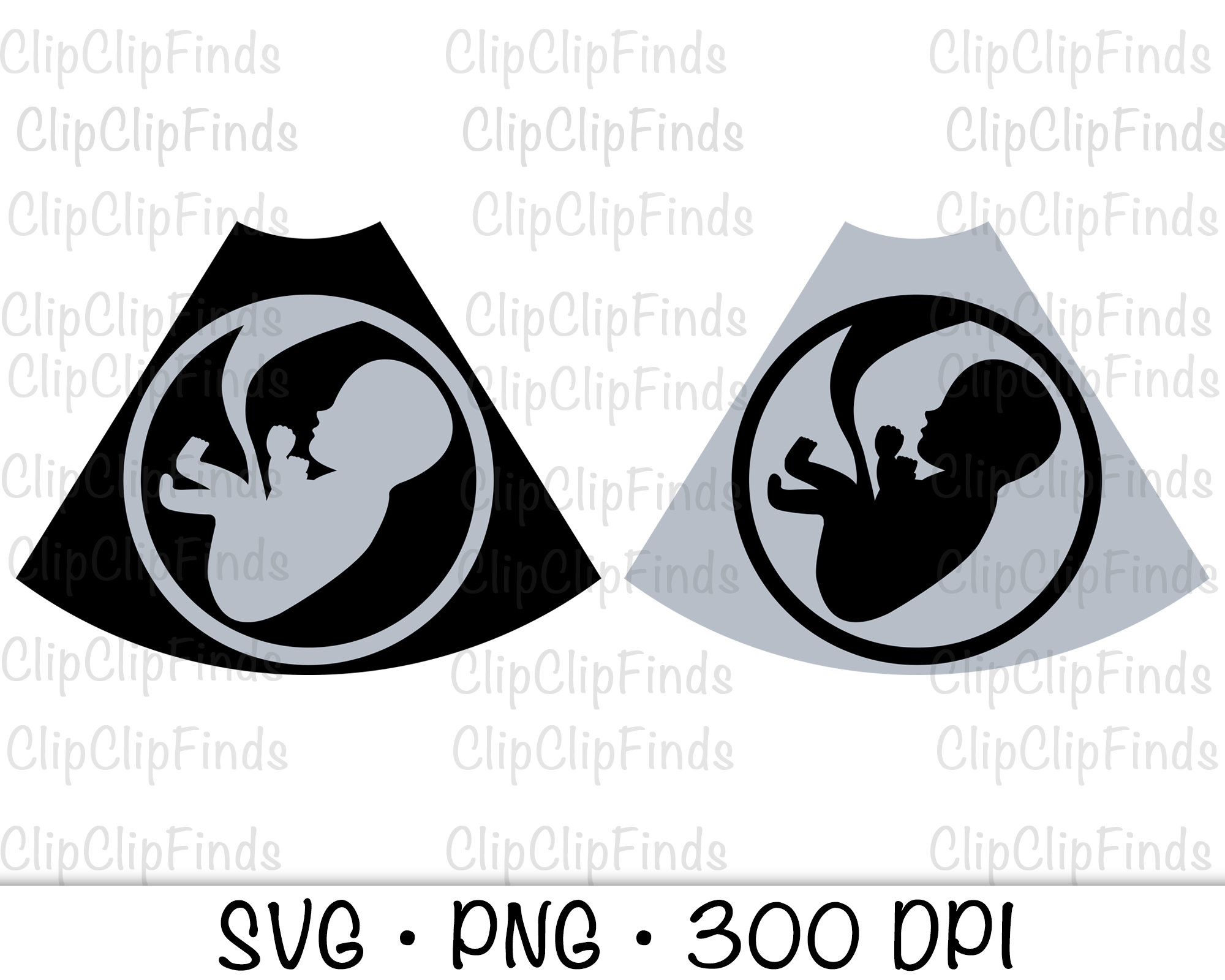 Baby Sonogram Embryo Fetus SVG PNG Instant Digital - Etsy