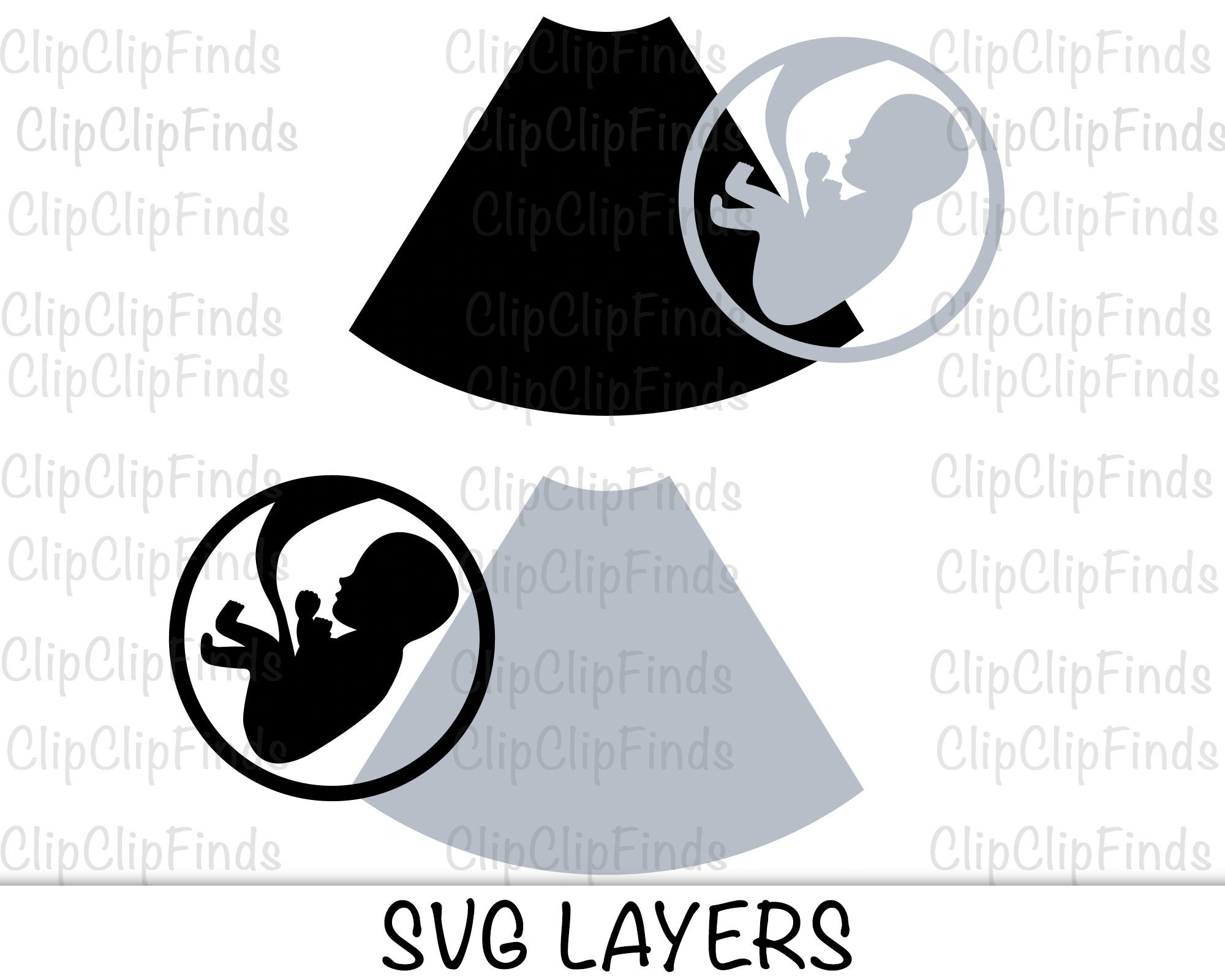 Baby Sonogram Embryo Fetus SVG PNG Instant Digital - Etsy
