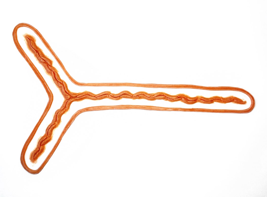 Y-incision Prosthetic / Encapsulated Silicone Prosthetic / Autopsy ...