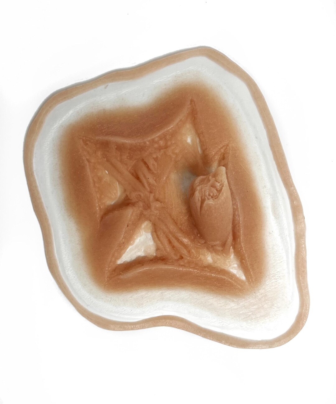 Open Arm Fracture Trauma/ Broken Bone/ Mangled Prosthetic / Special ...