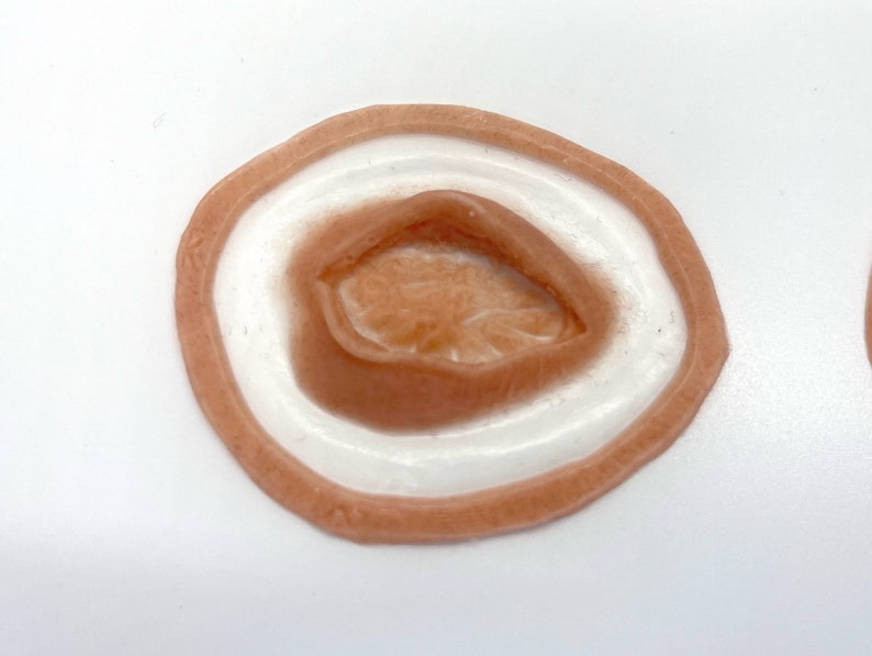 Gouged-out Eyes / Encapsulated Silicone Prosthetic / SFX Missing ...