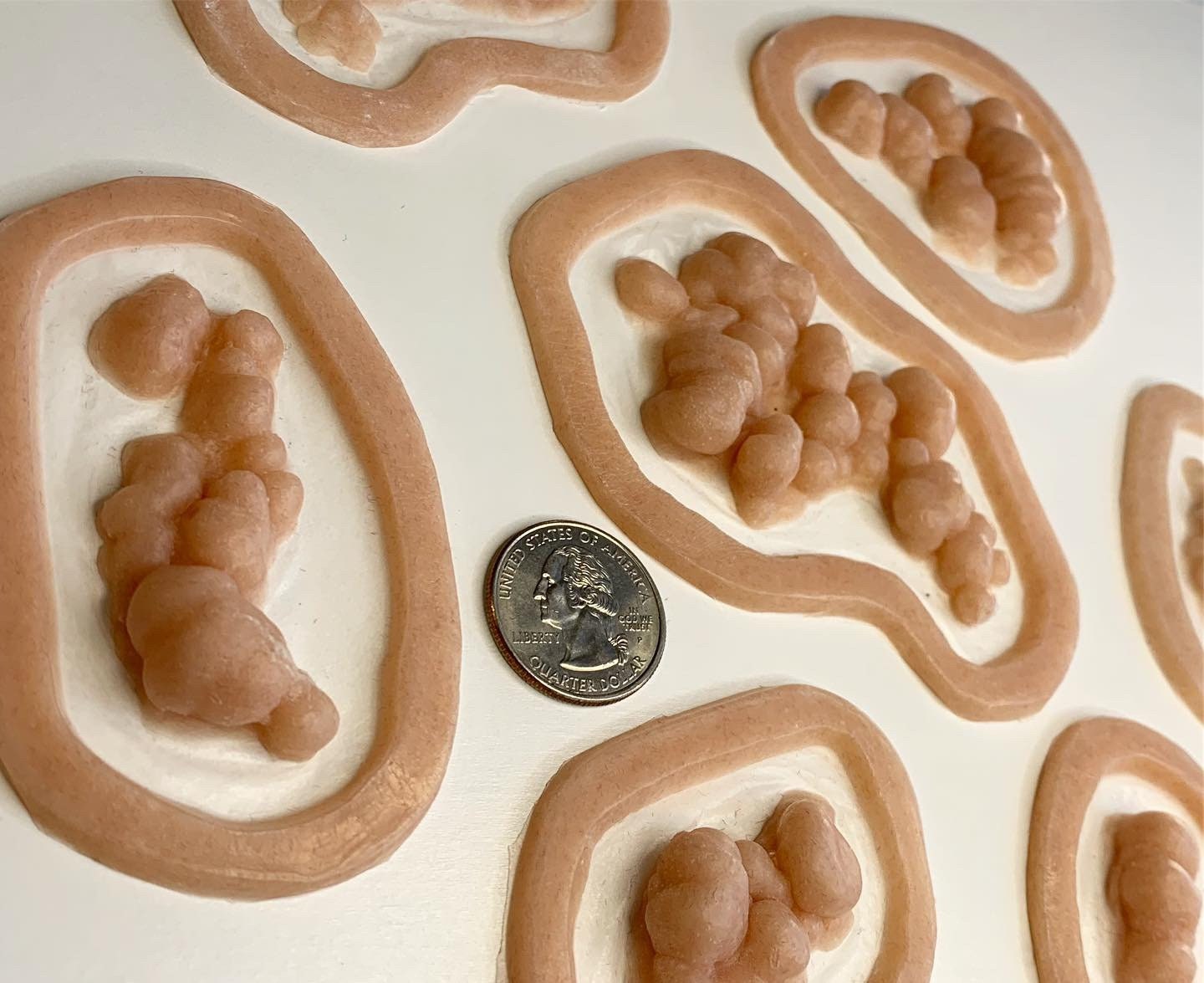 Cyst Growth Pack / Boils / Encapsulated Silicone Prosthetic / - Etsy
