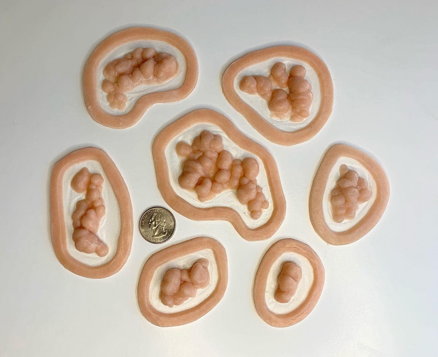 Cyst Growth Pack / Boils / Encapsulated Silicone Prosthetic / - Etsy