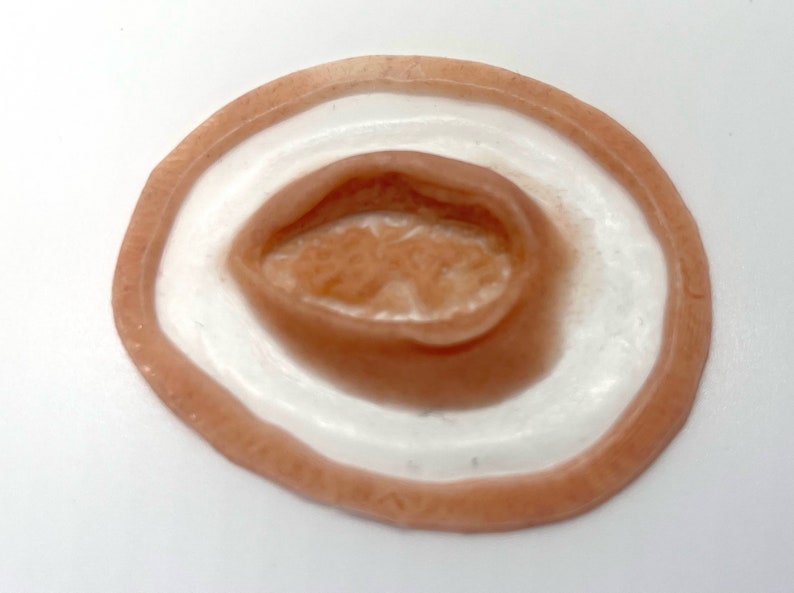 Gouged-out Eyes / Encapsulated Silicone Prosthetic / SFX Missing ...