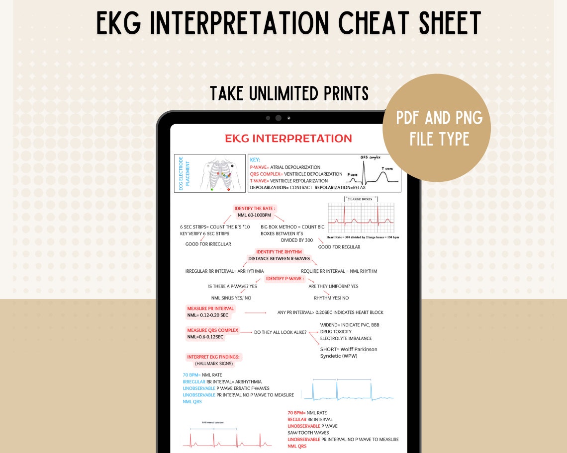 EKG Interpretation Cheat Sheet: Dysrhythmias, ECG Rhythm (digital ...