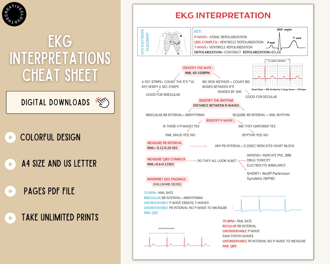 EKG Interpretation Cheat Sheet: Dysrhythmias, ECG Rhythm (digital ...
