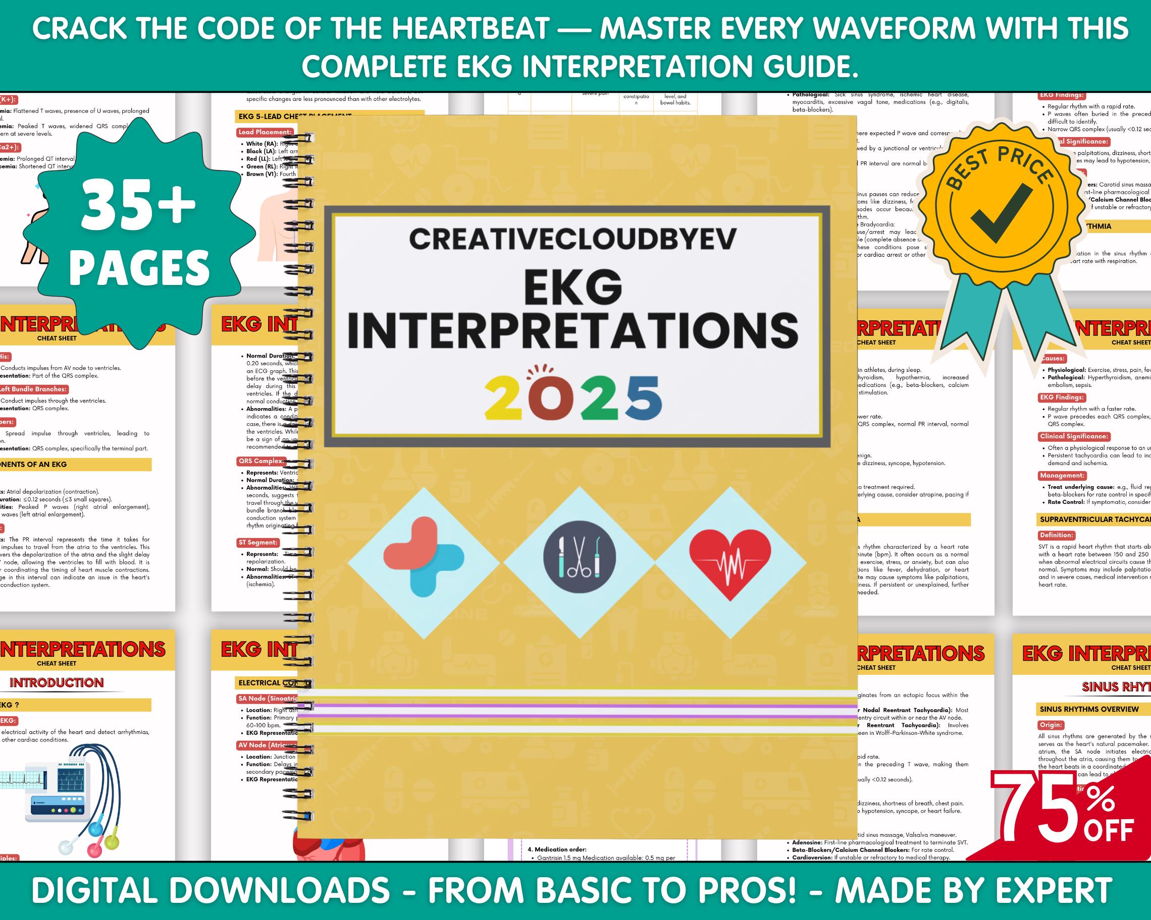 EKG Interpretation Study Guide: Nursing School Cardiac Rhythms (digital ...