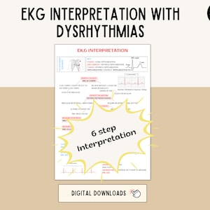 EKG Interpretation Cheat Sheet: Dysrhythmias, ECG Rhythm (digital ...