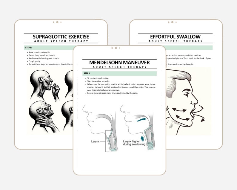 Dysphagia Pack, PDF, Patient Handouts, Worksheets, Resources ...