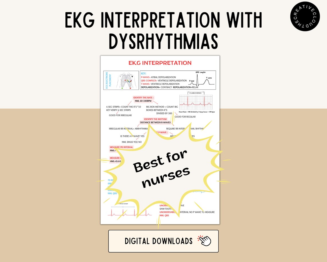 EKG Interpretation Cheat Sheet: Dysrhythmias, ECG Rhythm (digital ...