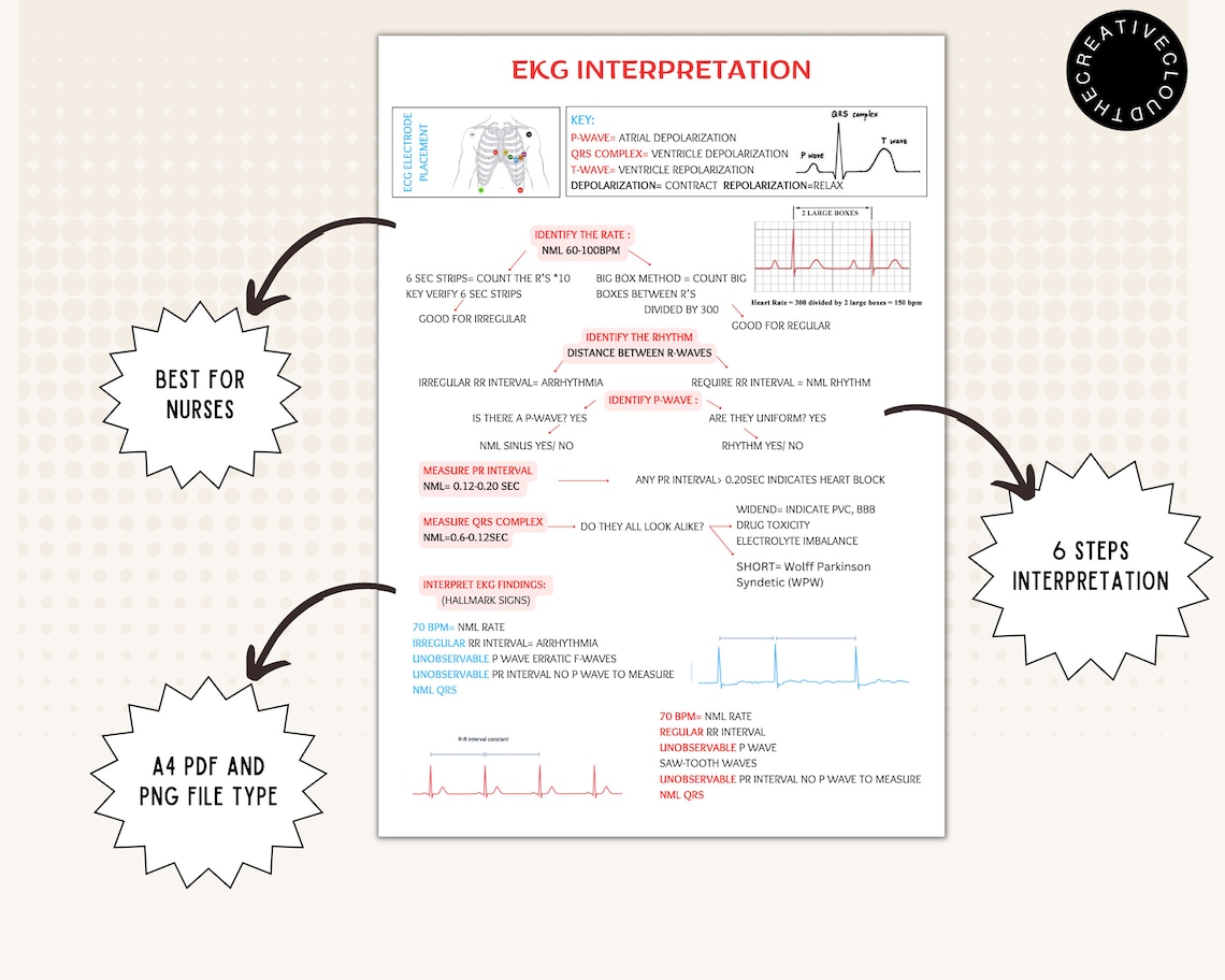 EKG Interpretation Cheat Sheet: Dysrhythmias, ECG Rhythm (digital ...