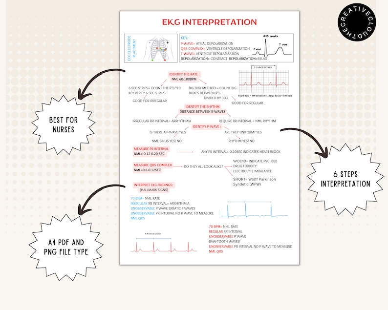 EKG Interpretation Cheat Sheet: Dysrhythmias, ECG Rhythm (digital ...