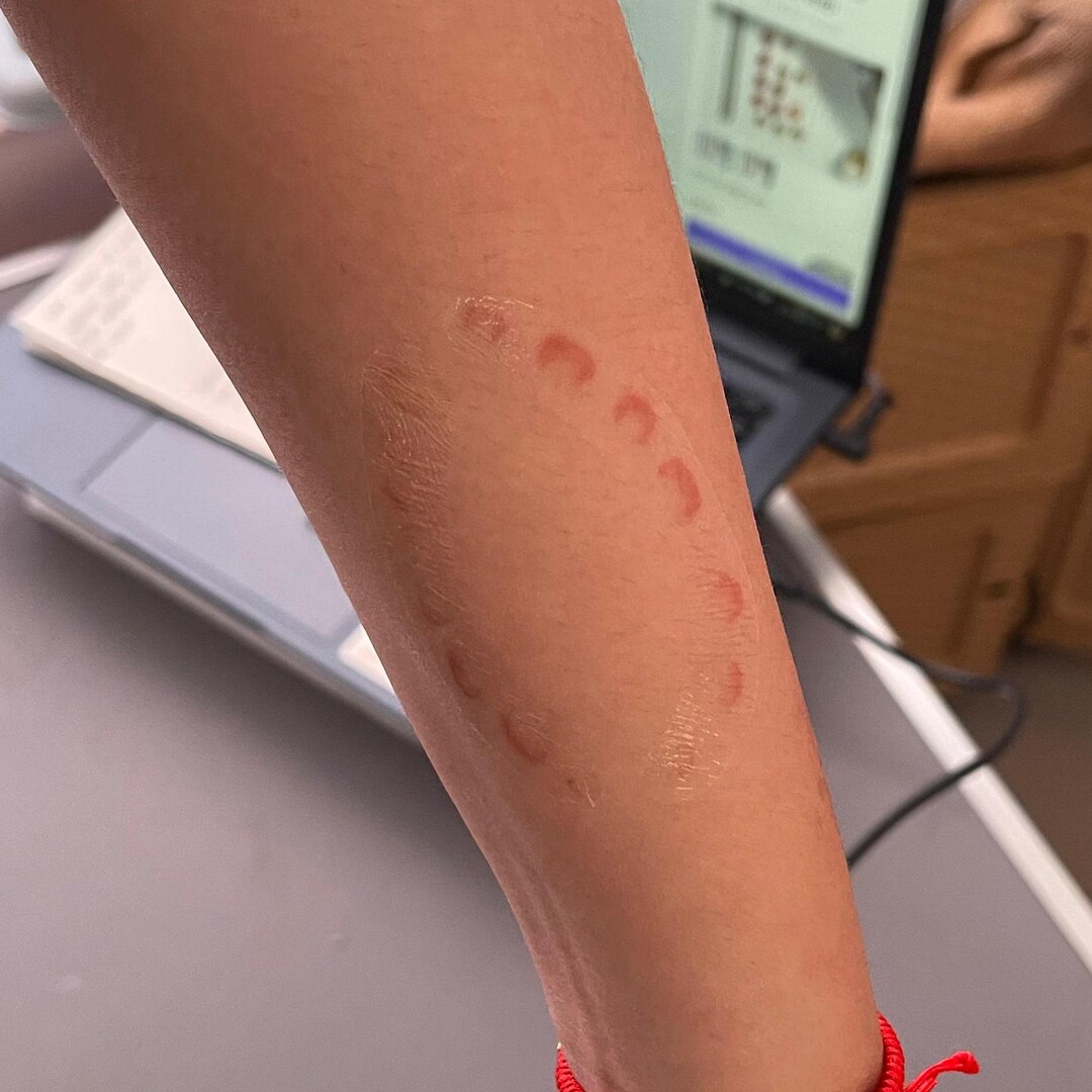 Human Bite Wound Fake Scar SFX, Cuts Scratch Tattoo Temporary Tattoo ...