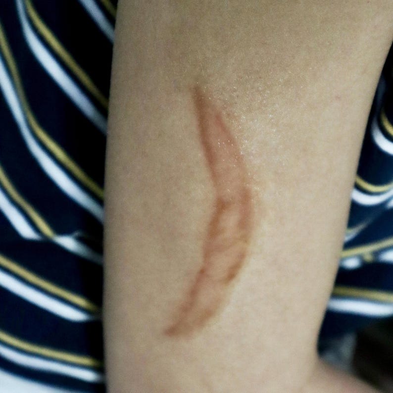 Realistic Keloid Scar Temporary Tattoo: SFX Makeup, Cosplay Prop - Etsy