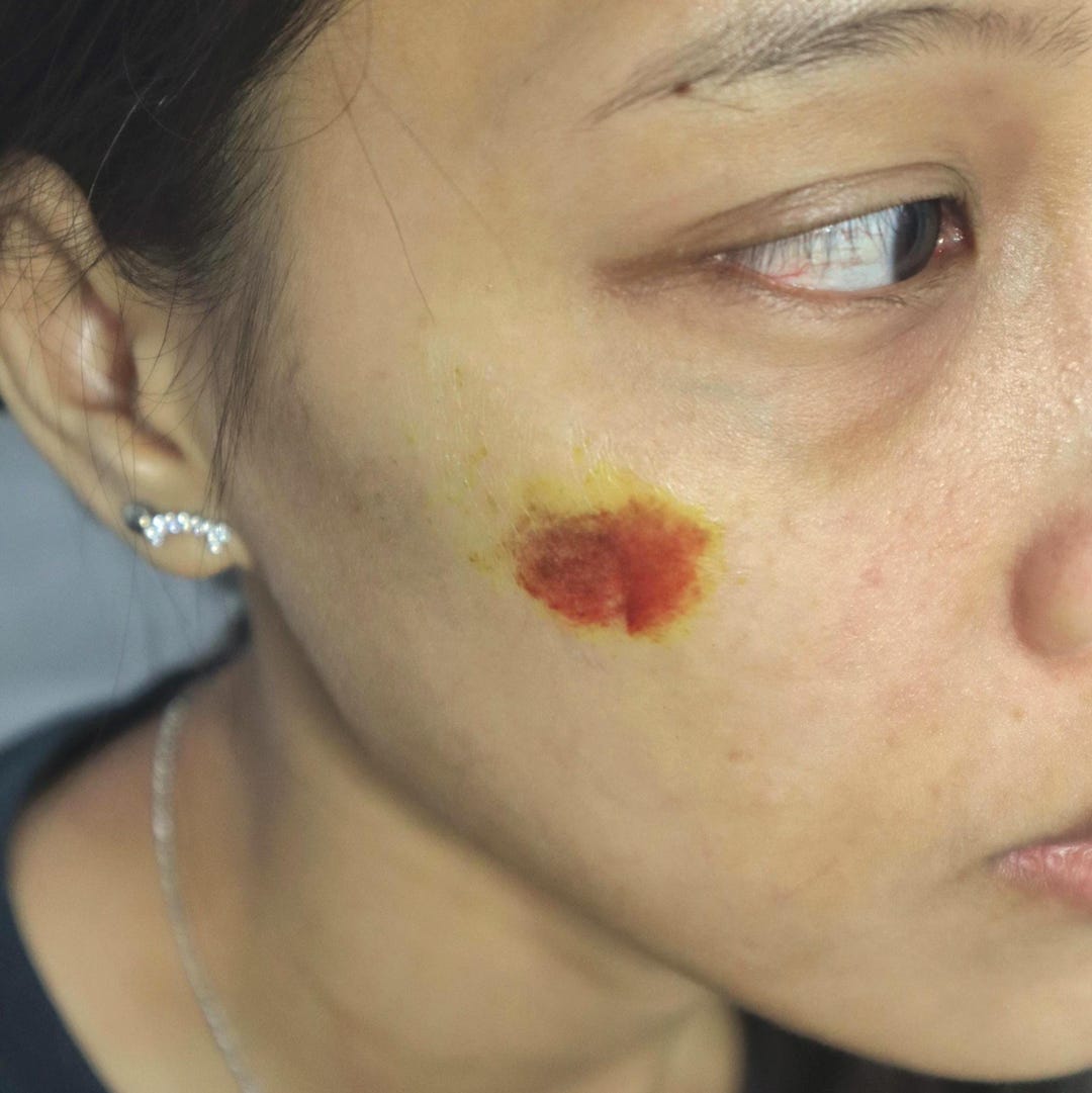 Realistic Face Healing Bruise Temporary Tattoo: SFX Halloween Cosplay ...