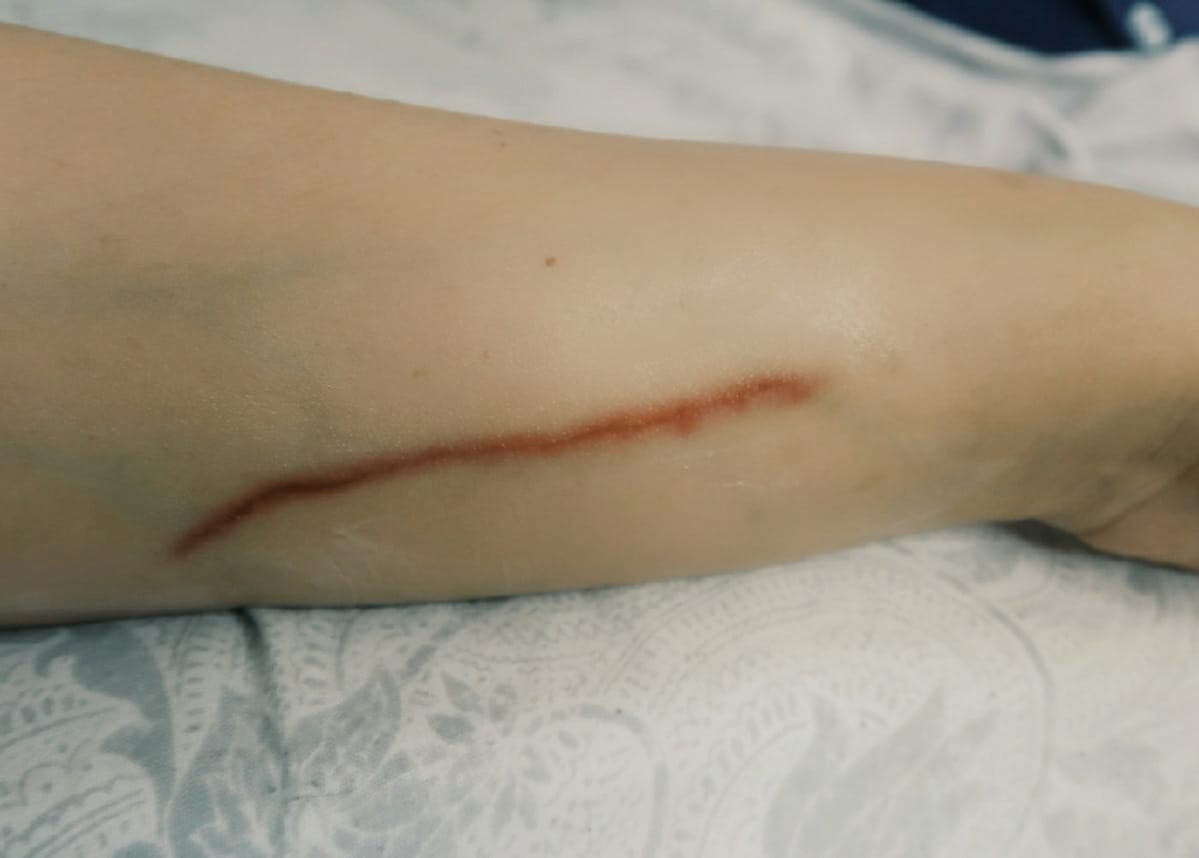 Realistic Graze SFX Scar Tattoo Fake Cut Temporary Tattoo - Etsy Canada