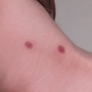 Vampire Bite SFX Temporary Tattoo | Halloween Accessory | Halloween ...