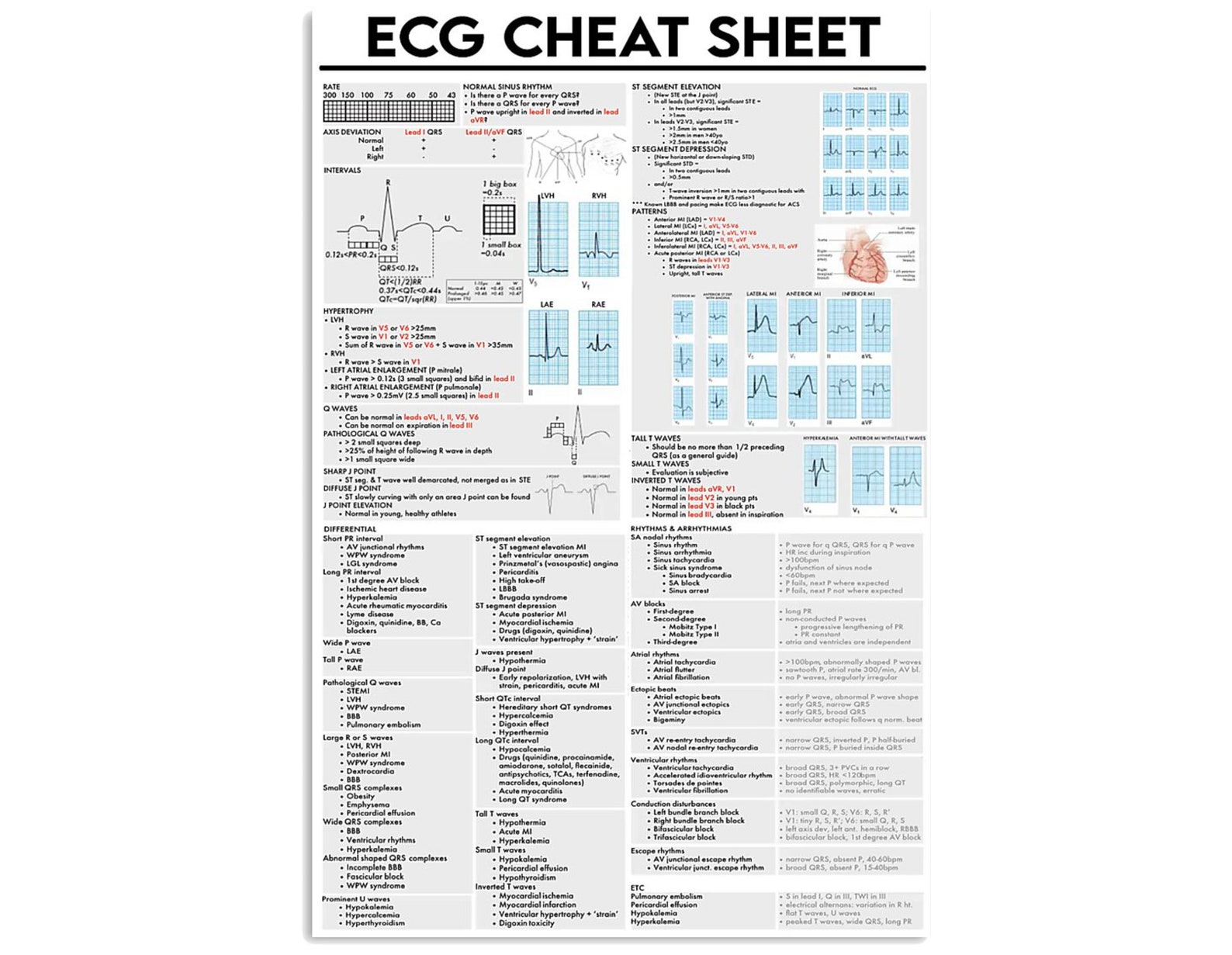 Paramedic ECG Cheat Sheet Electrocardiography Paramedic | Etsy