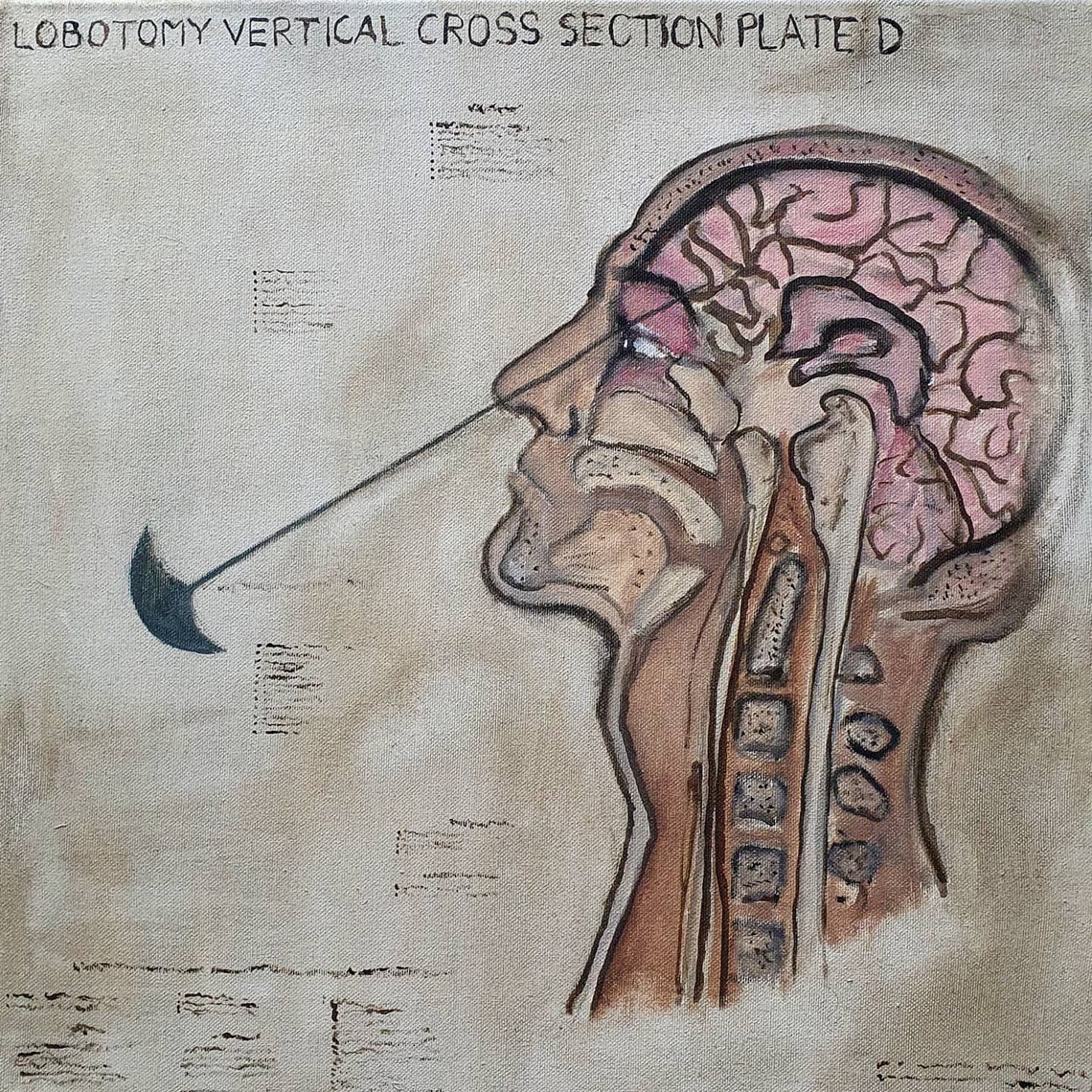 Lobotomy | Etsy