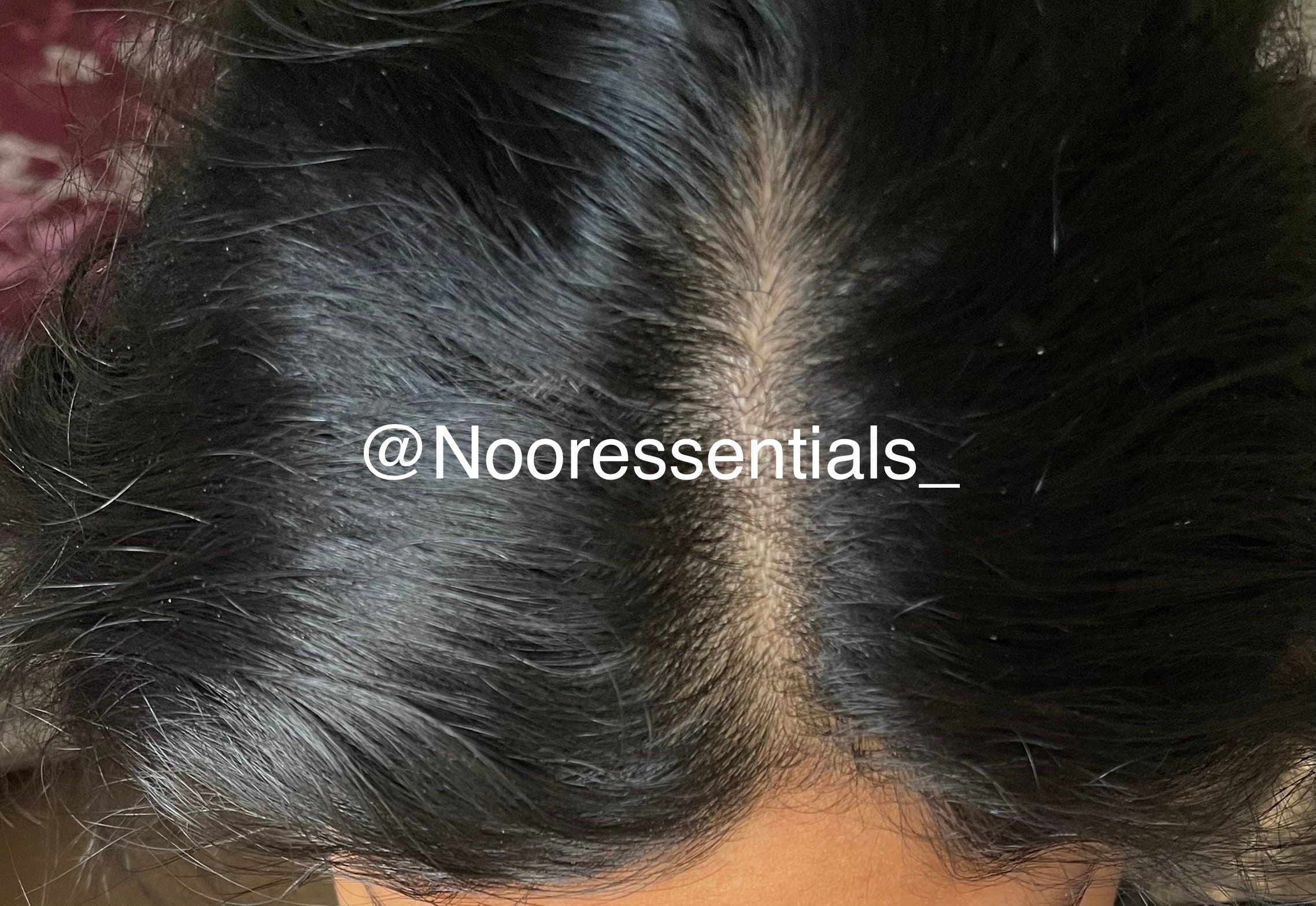 Hair Growing Oil: REVIVE Hair Oil Renew Repair Regrow - Etsy