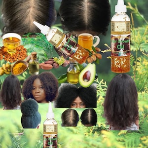 Organic Hair Solution-bundle 6 In1 Hair Growth Kit-for All Hair ...