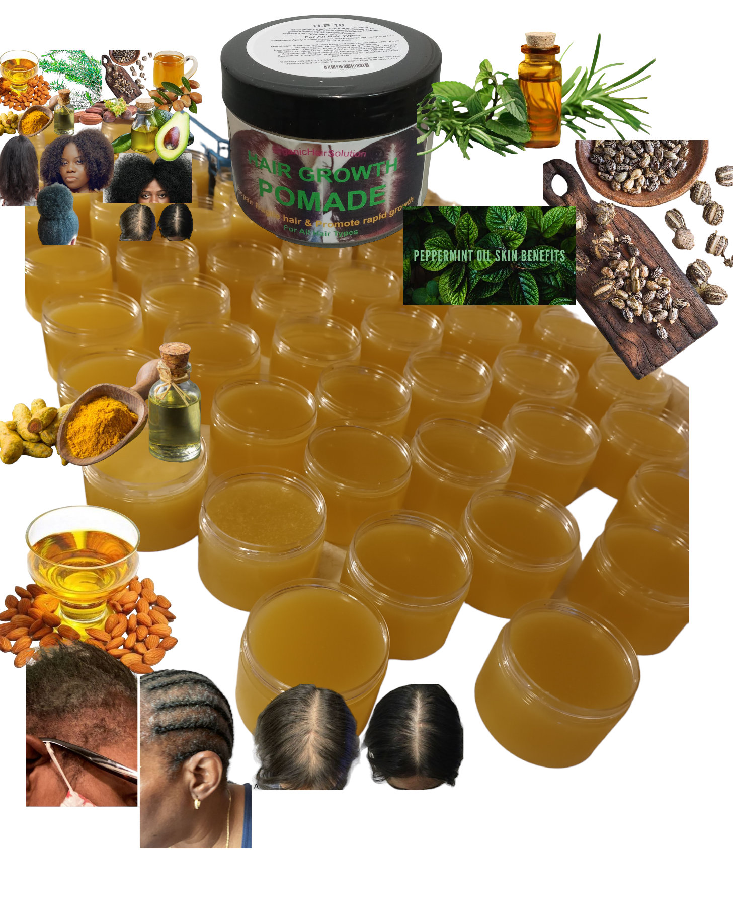 Organic Hair Solution-hair Growth Pomade - Stops Itchy, Dry Scalp ...