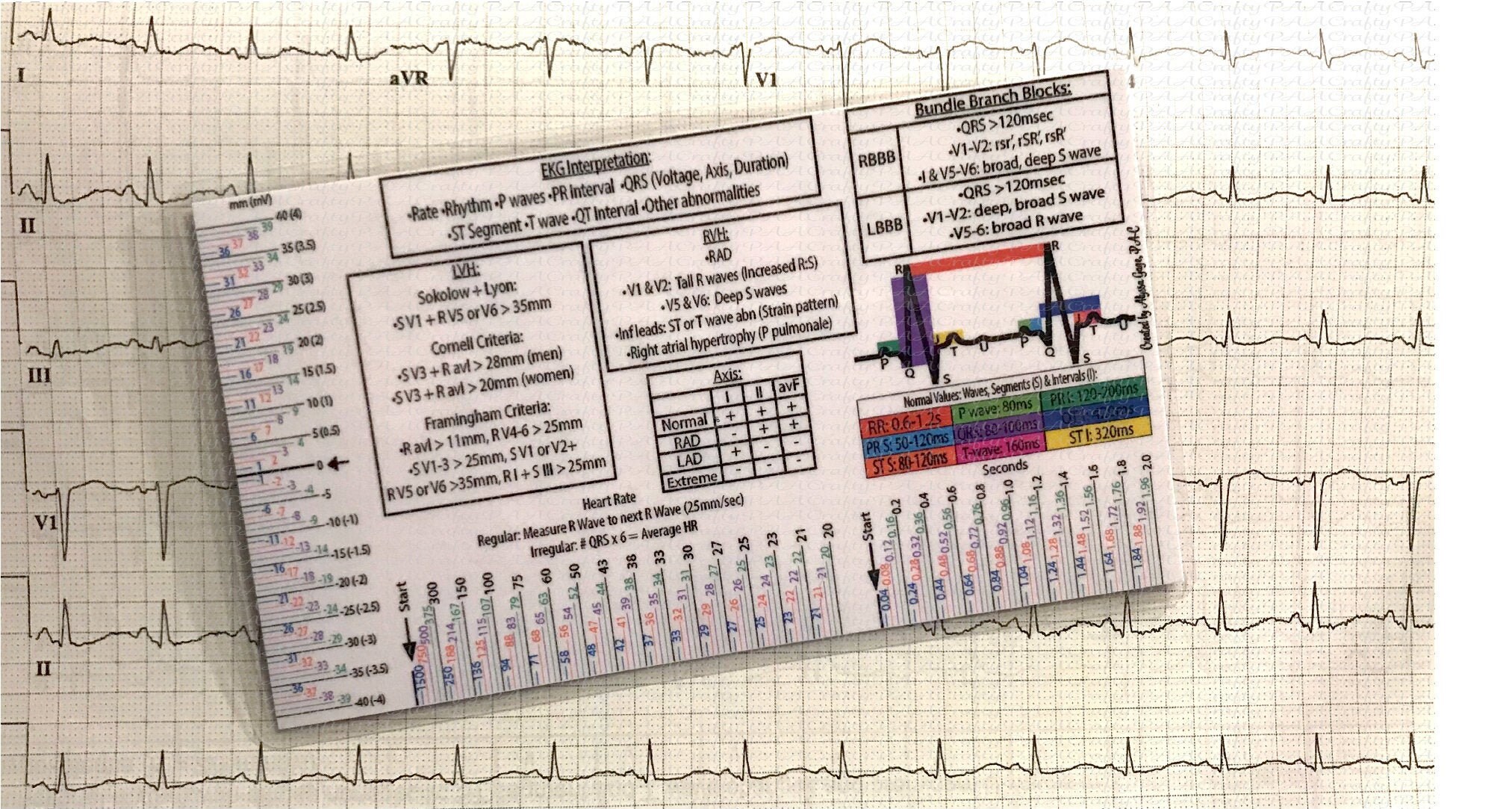 Regla de electrocardiograma Guía de bolsillo EKG ELECTRO Pa | Etsy