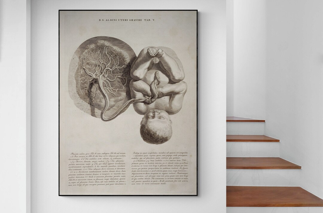Fetus in Womb Pregnancy Anatomy Medical Chart Antique Old Vintage ...