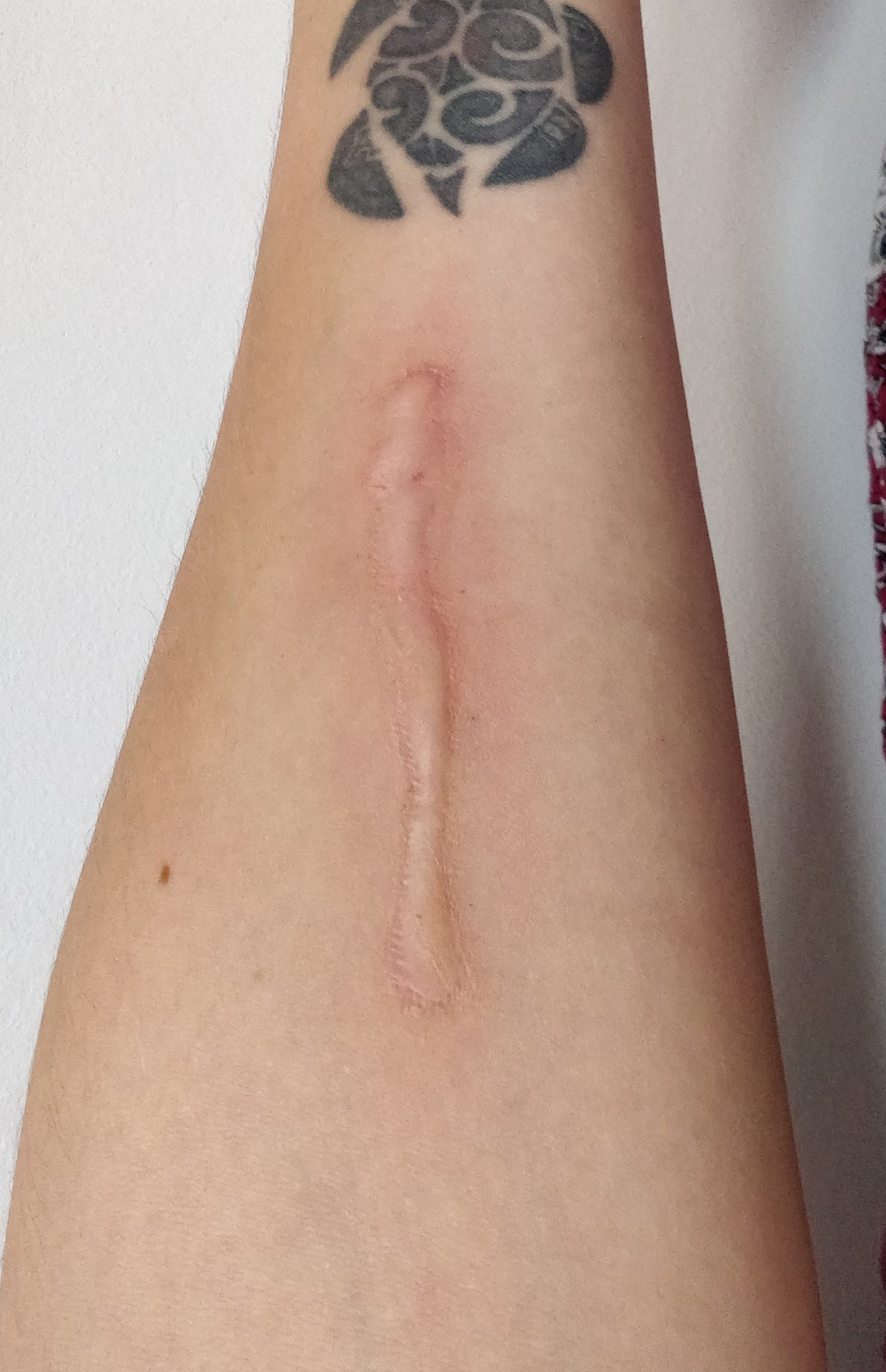 Realistic Surgical Scar Prosthetic Appliance - Etsy