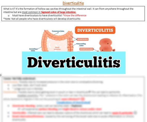 Diverticulitis & Diverticulosis Nursing Study Guide | Etsy Australia