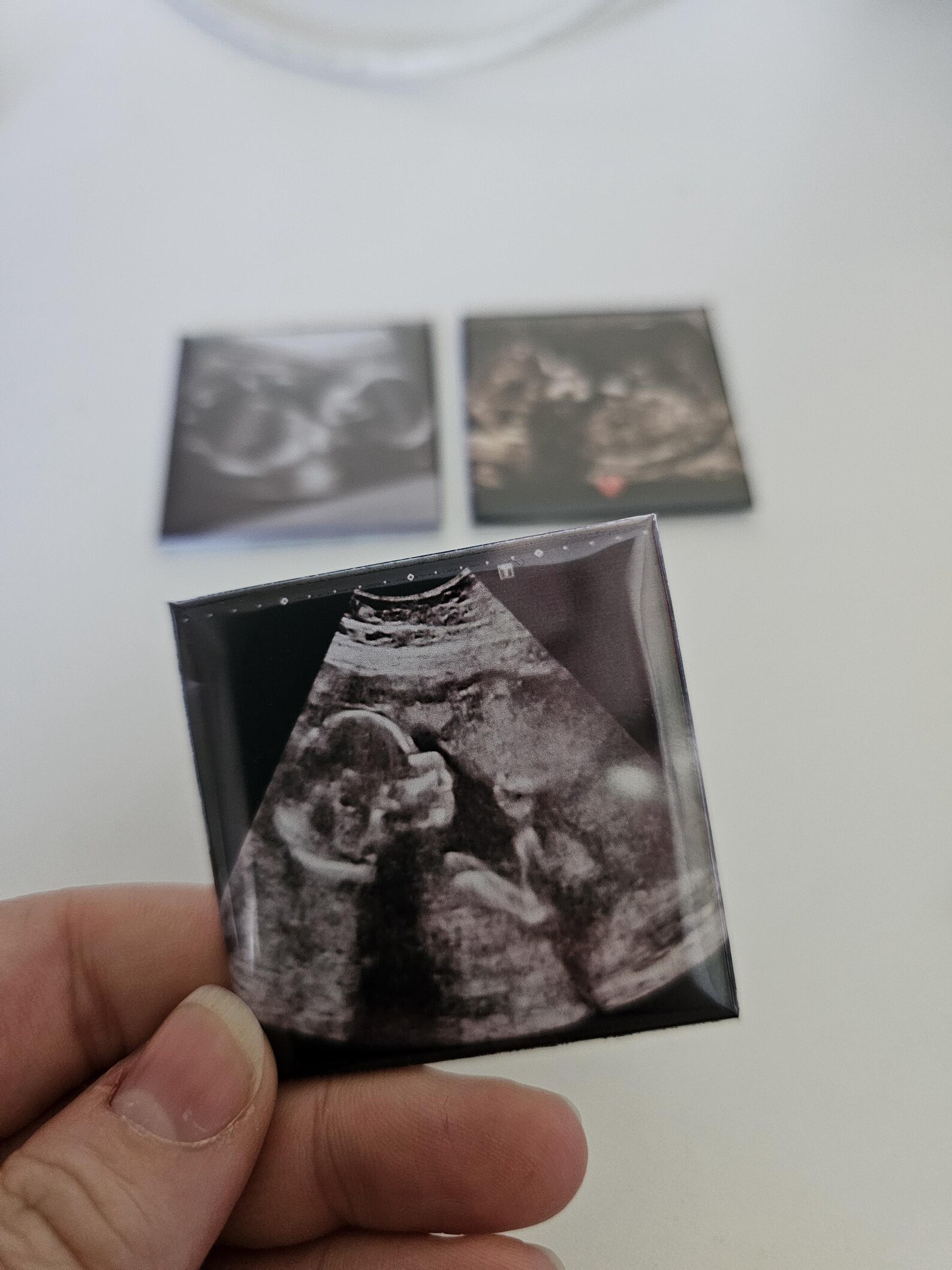 Ultrasound Photo Magnet Keepsake: Baby Scan Gift, Pregnancy ...