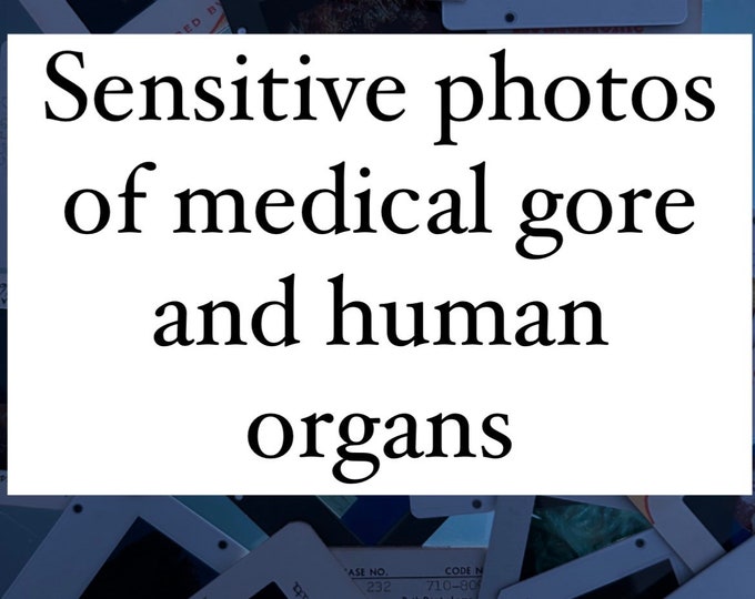 Five Random Vintage Medical Slides of Human Organs and Diseased Tissue ...