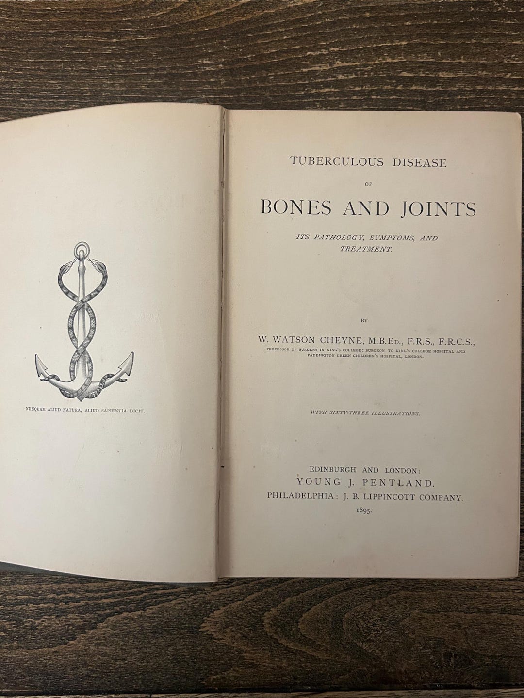 Victorian Medical Text From 1895, Tuberculosis Disease of Bones and ...
