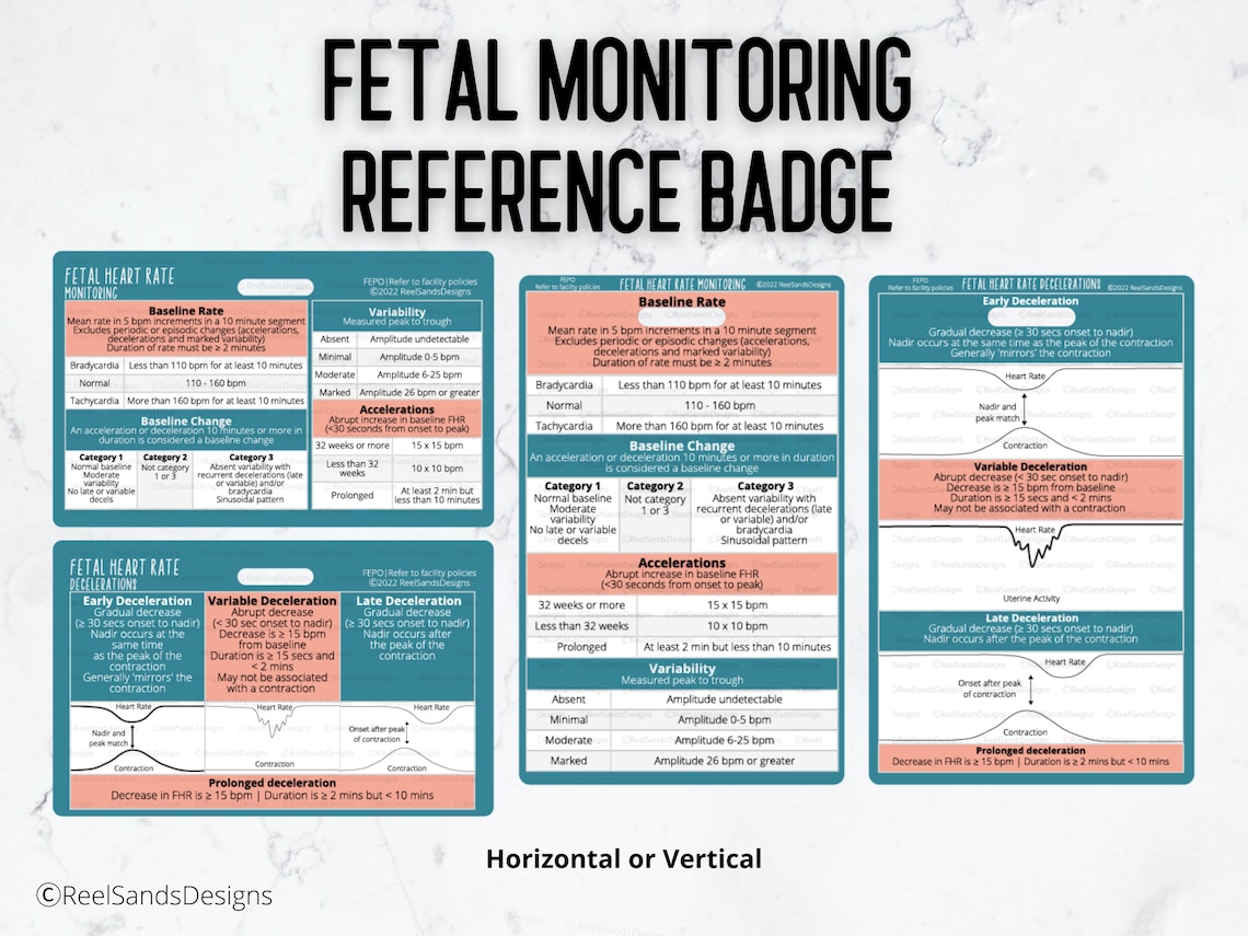 Fetal Monitoring EFM Quick Reference Badge Buddy Card Decels - Etsy