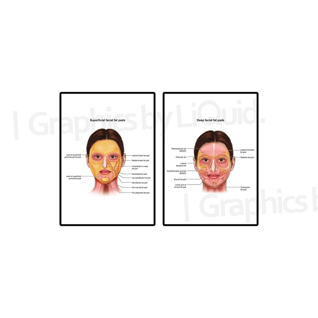 Face Anatomy Detailed Muscle Vein Facial Fat Pad Facial Structure ...