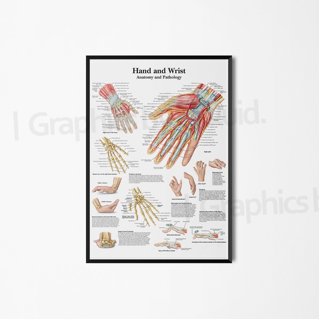 Hand and Wrist Anatomy and Pathology Details Chart Structure Medical ...