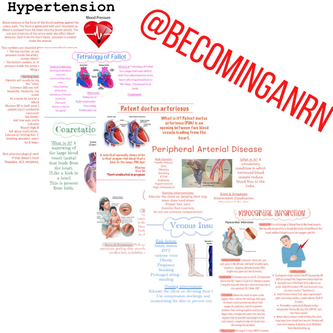 Cardiac Bundle - Nursing School Notes - Digital Download - Etsy