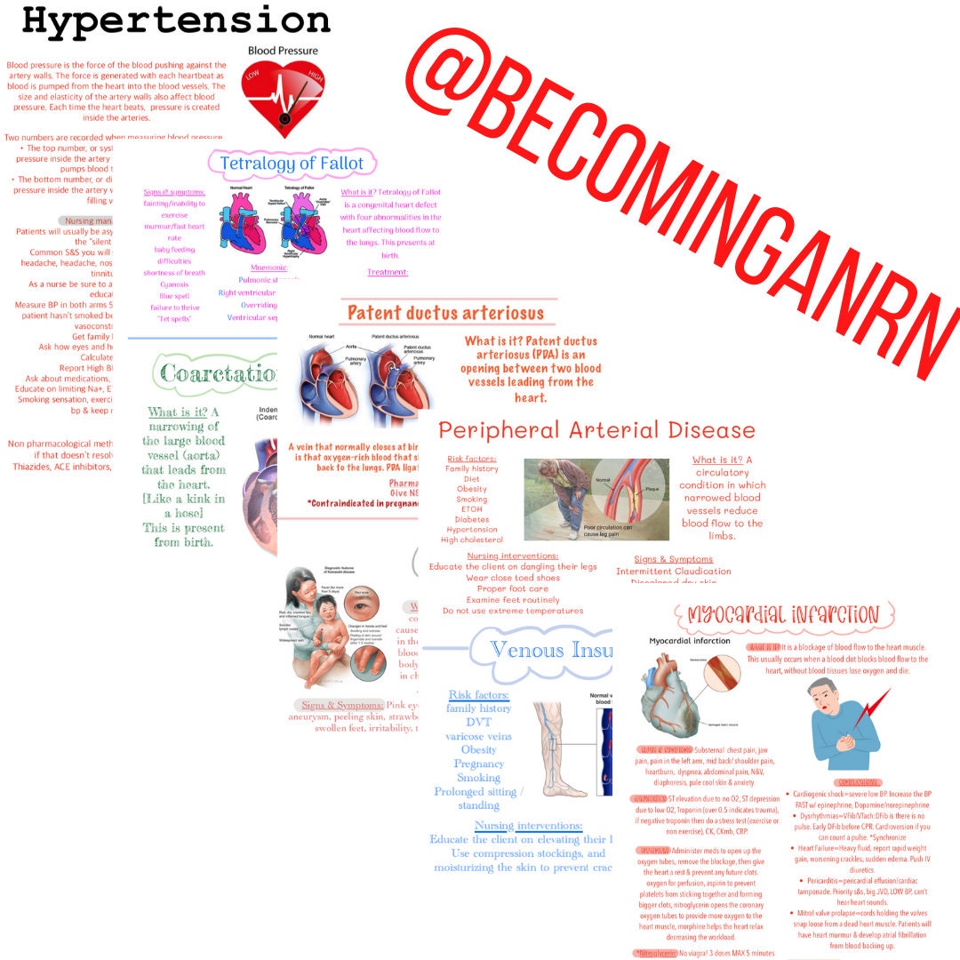 Cardiac Bundle - Nursing School Notes - Digital Download - Etsy