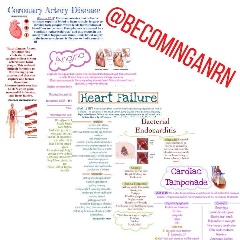 Cardiac Bundle - Nursing School Notes - Digital Download - Etsy