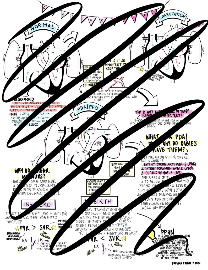 Normal Circulation + PDA/PFO: Nicu Nursing & Nnp Notes - Etsy
