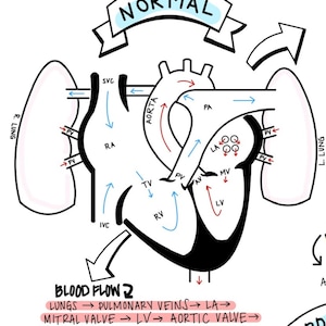 Normal Circulation + PDA/PFO: Nicu Nursing & Nnp Notes - Etsy